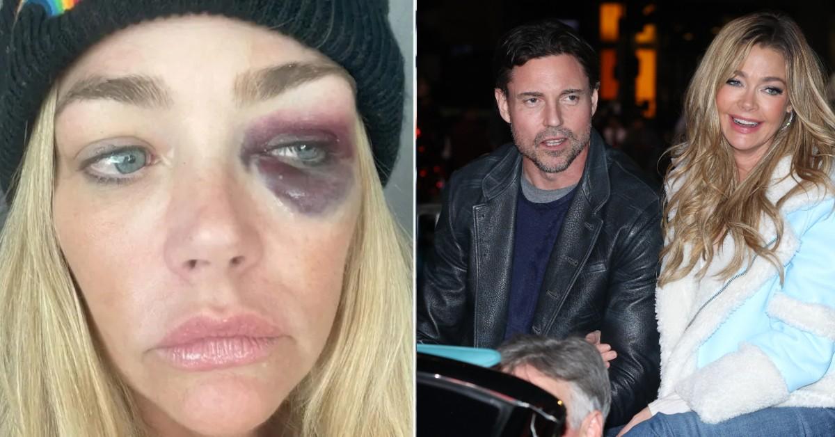 Denise Richards' Husband Denies Hitting Star And Blames Her Booze Issues