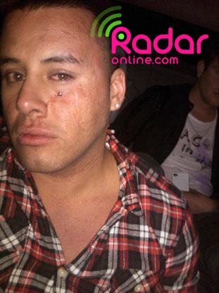 EXCLUSIVE PHOTOS: The A List Star TJ Kelly Beat Me Up: Talent Agent