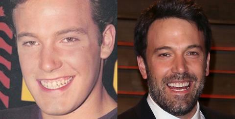 Snap On Smiles: Can You Guess The Hollywood Star Behind These Picture ...