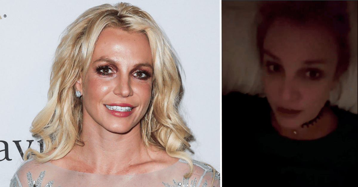 Britney Spears Sparks Concern After Telling Face Burn Story With Accent
