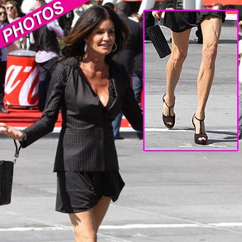 Celebrities Aren’t Perfect! Janice Dickinson Shows Off Wrinkly, Aging Legs