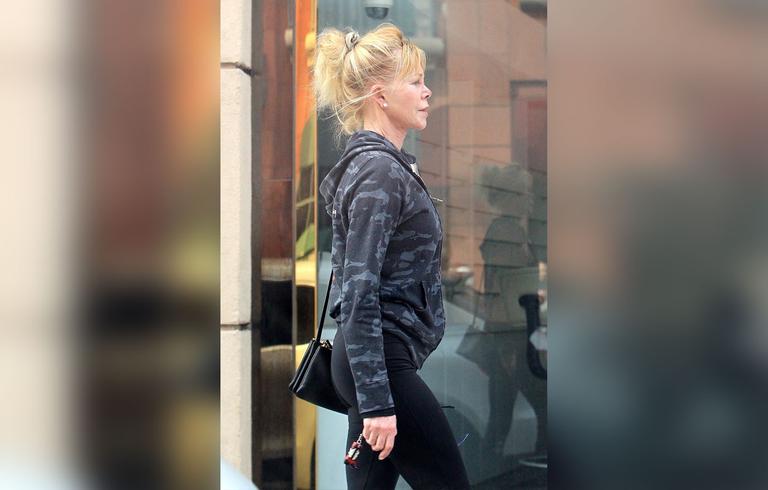 Melanie Griffith Wears Nose Bandage After Skin Cancer Treatment