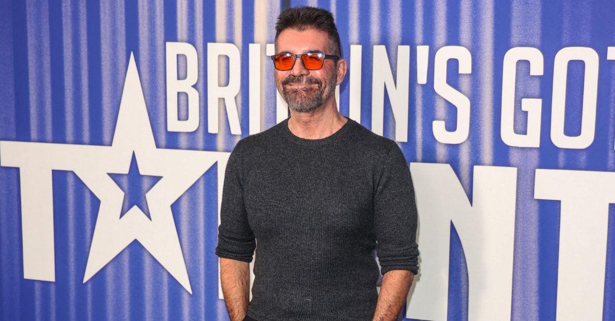 Simon Cowell Shows Off Head Injury After Suffering Nasty Fall