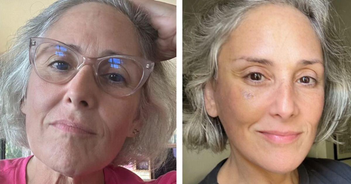 Ricki Lake Boasts About Neck and Facelift After Losing 40 Pounds