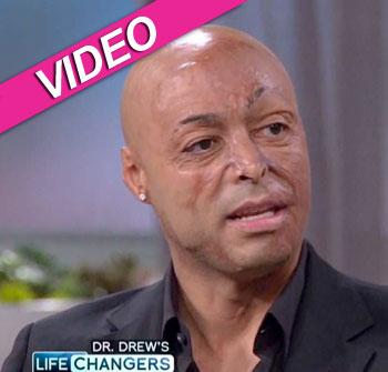 DWTS’ J.R. Martinez On Why He Was 'Kept In This World'