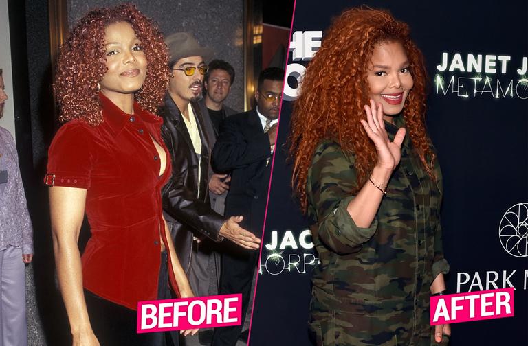 Janet Jackson Shocking Plastic Surgery Makeover Revealed