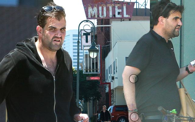 Billionaire To Rock Bottom: Jason Davis Covered In Track Marks At Seedy ...