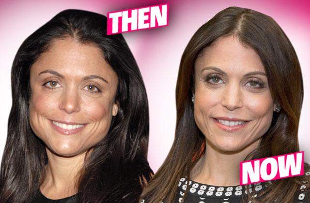 Bethenny's Had 'Invasive & Traumatic' Plastic Surgery To Jaw & Eyes