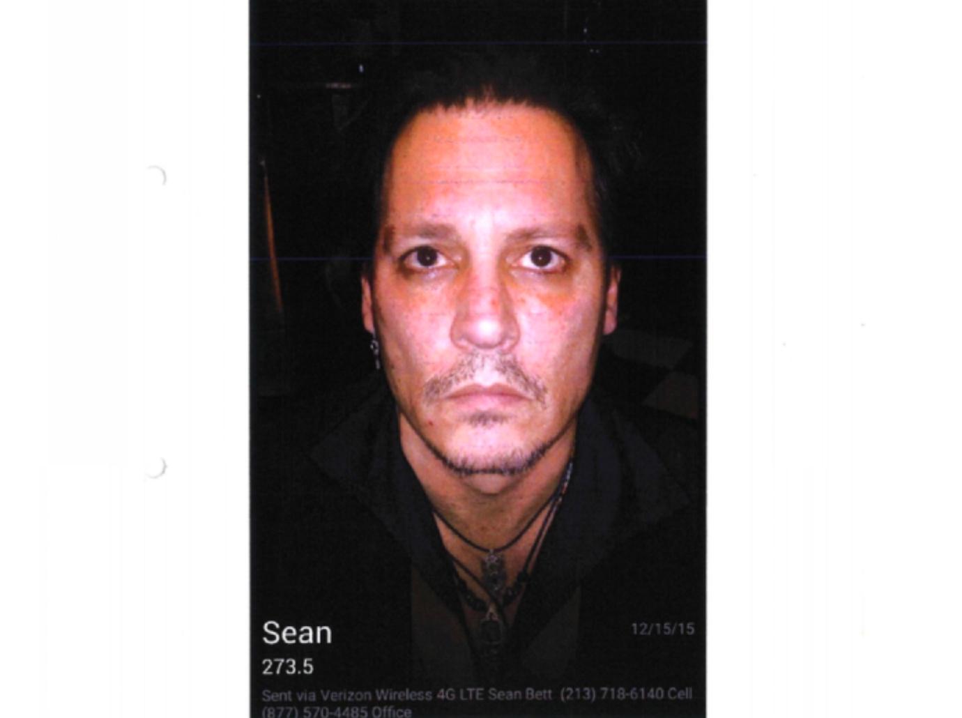 Johnny Depp Reveals Photos Of Alleged Injuries From Amber Heard Fights