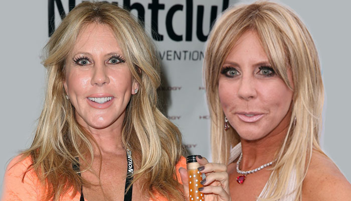 Vicki Gunvalson On Her Plastic Surgery: ‘Some People Say I Shouldn’t ...