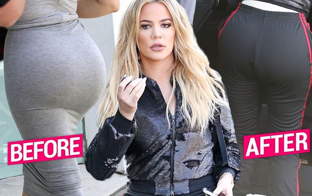 Khloe Kardashian Butt Implant Rumors -- KUWTK Star Booty Is Deflating ...