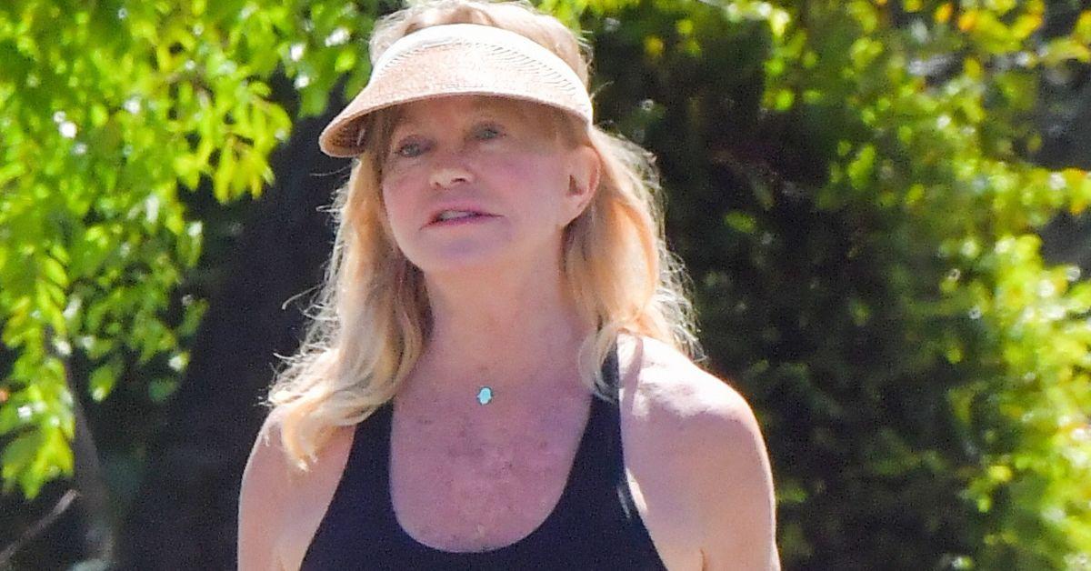 Goldie Hawn Sparks Shock With 'Bloated, Distorted, Puss-Filled Face'