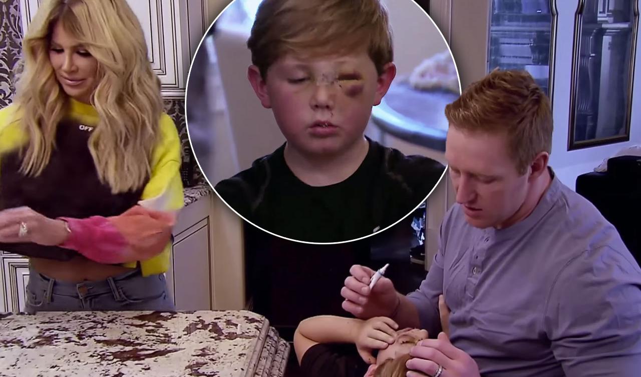 Kash Biermann Deals With Painful Eye Injury After Dog Bite