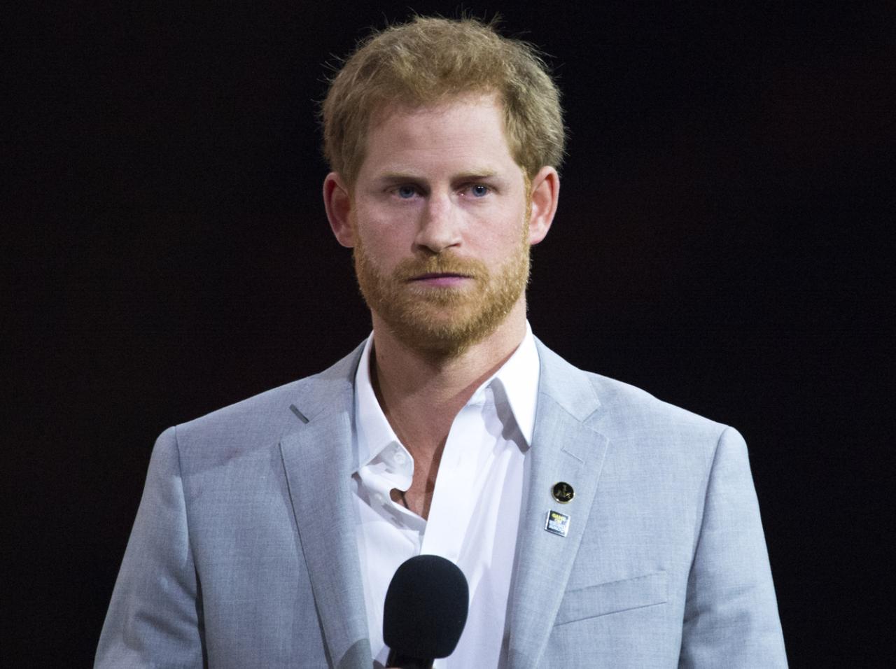 Prince Harry's Hair Loss Isn't Due To Stress, Expert Blames Prince Charles Prince Harry's Hair Loss Isn't Due To Stress, Expert Blames Prince Charles
