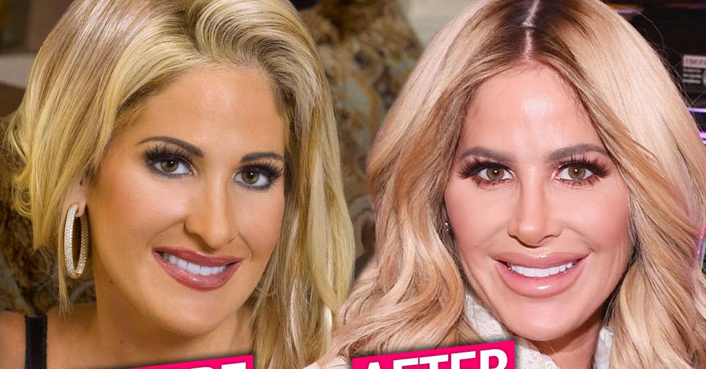 [PICS] Kim Zolciak Unrecognizable In Old Pics After Plastic Surgery