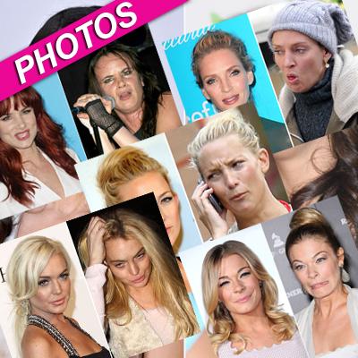 Say Cheese! Even More Bad Photos Of Stunning Celebrities