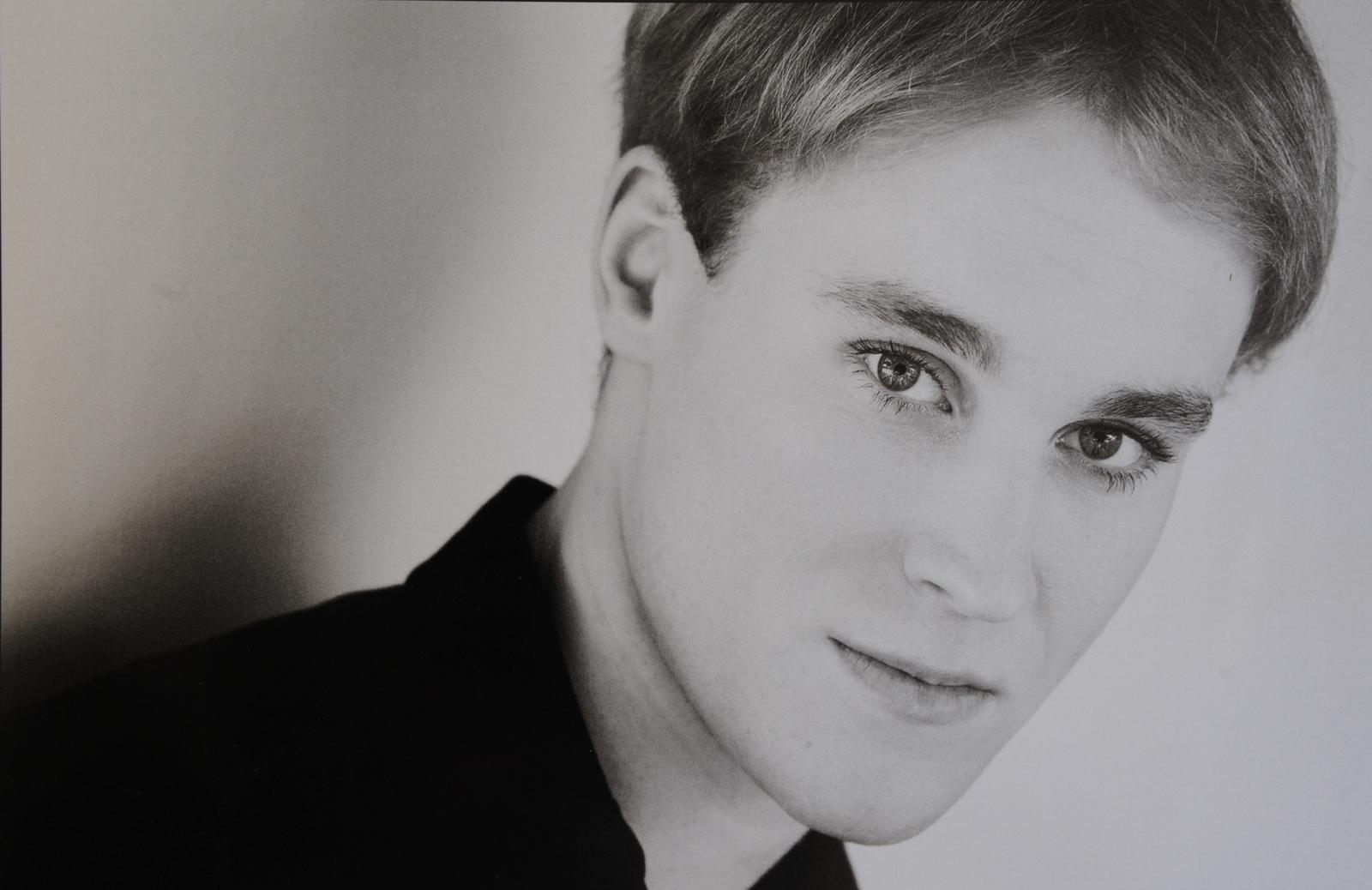 Justin Bieber Fanatic Toby Sheldon Has Plastic Surgery To Look Like The ...