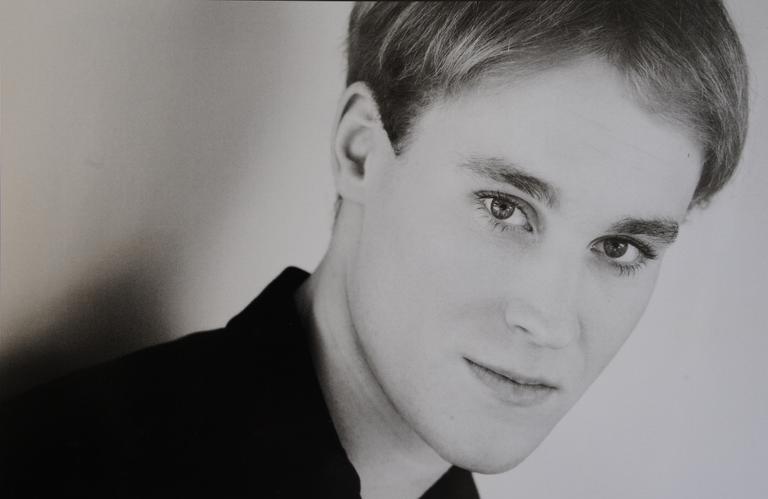 Justin Bieber Fanatic Toby Sheldon Has Plastic Surgery To Look Like The ...