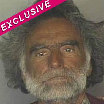 Homeless Face-Eating Victim In Line For Over $100,000 Reconstructive ...