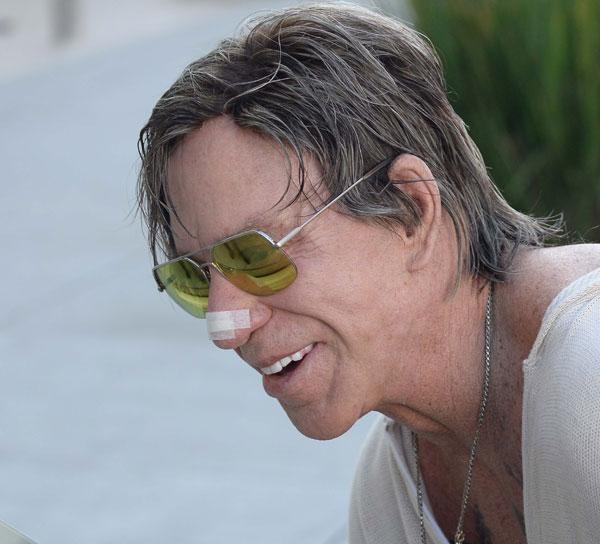 More Time Under The Knife For Mickey? Rourke Sports Bandaged Nose In 8 ...