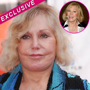 What Happened To Kim Novak’s Face? Aging Actress Shows Off ‘Puffer Fish ...