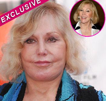 What Happened To Kim Novak’s Face? Aging Actress Shows Off ‘Puffer Fish ...