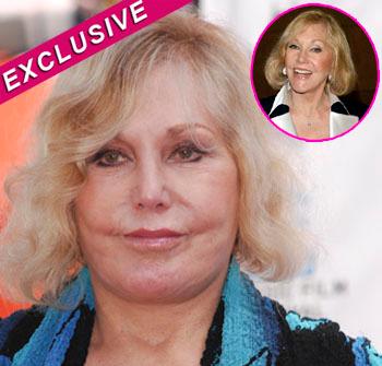 What Happened To Kim Novak’s Face? Aging Actress Shows Off ‘Puffer Fish ...