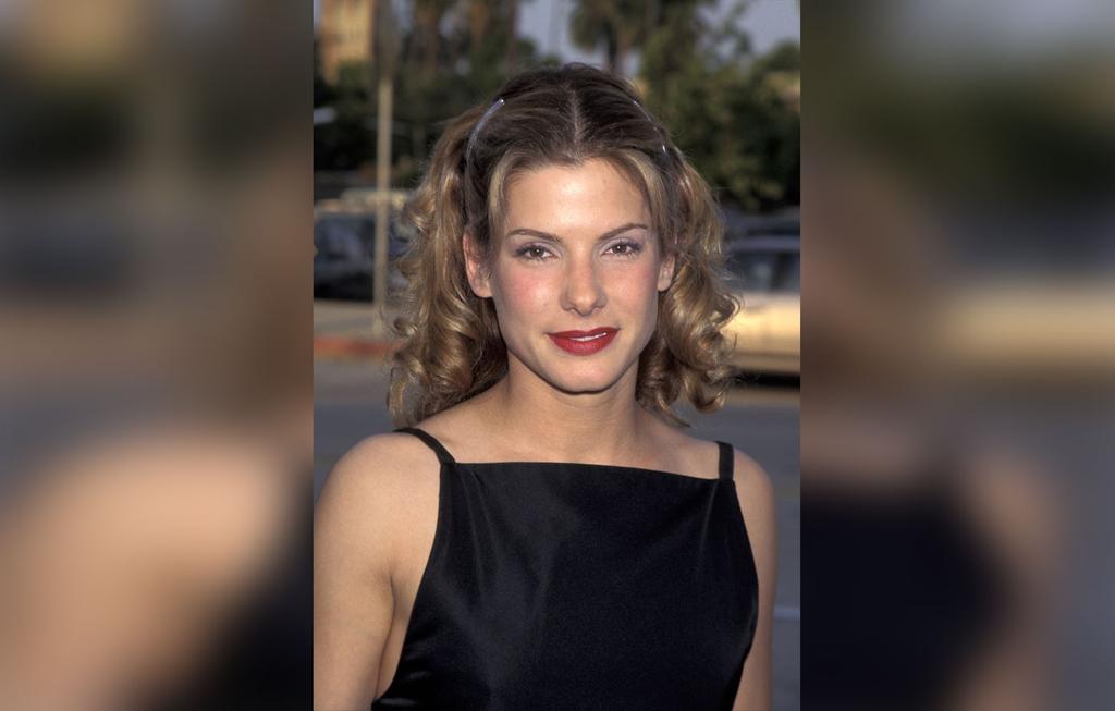 Sandra Bullock Fillers Puffy Cheek Fail