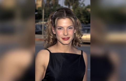 Sandra Bullock Fillers Puffy Cheek Fail