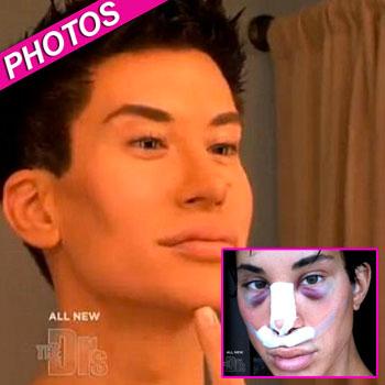 Move Over 'Human Barbie'! Real-Life 'Ken Doll' Has Spent Around ...