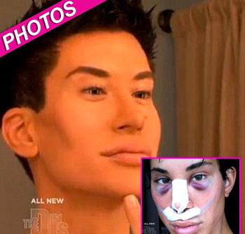 Move Over 'Human Barbie'! Real-Life 'Ken Doll' Has Spent Around ...