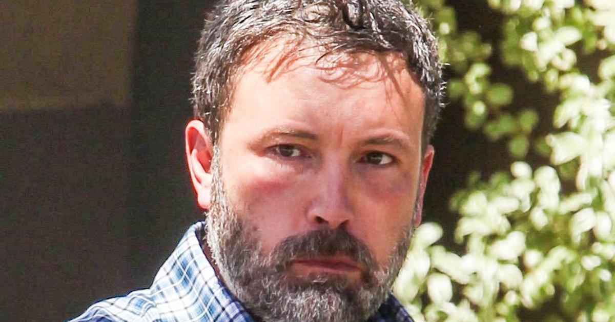 Heartbroken Ben Affleck: Wrinkled & Lonely After Scandalous Split