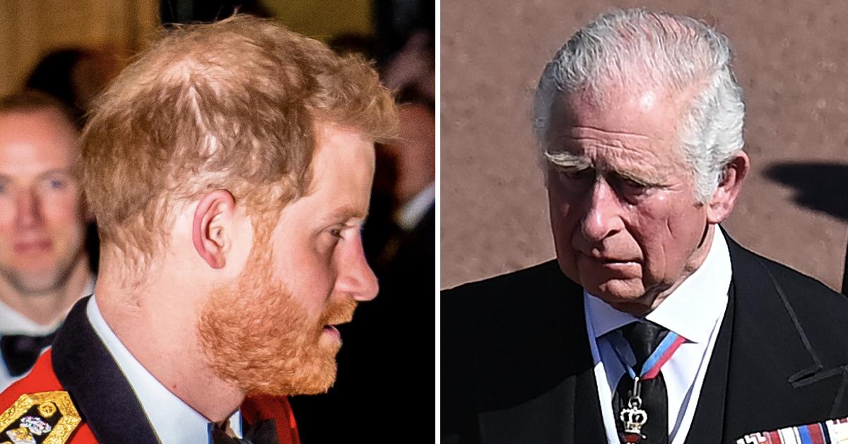 Prince Harry's Hair Loss Isn't Due To Stress, Expert Blames Prince Charles Prince Harry's Hair Loss Isn't Due To Stress, Expert Blames Prince Charles
