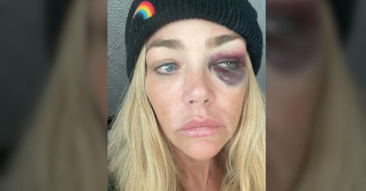Denise Richards' 'Star Power' Accusation In Aaron Phypers' Arrest