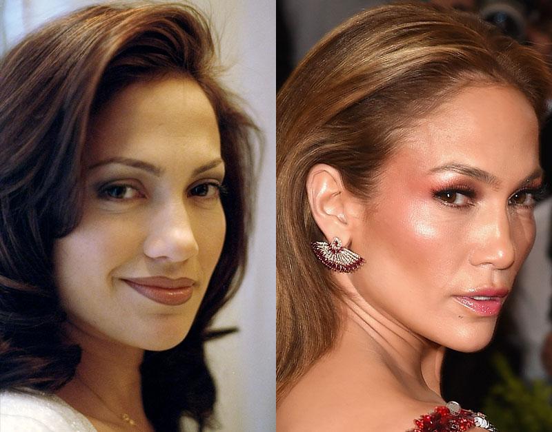 Secret Celebrity Nose Jobs