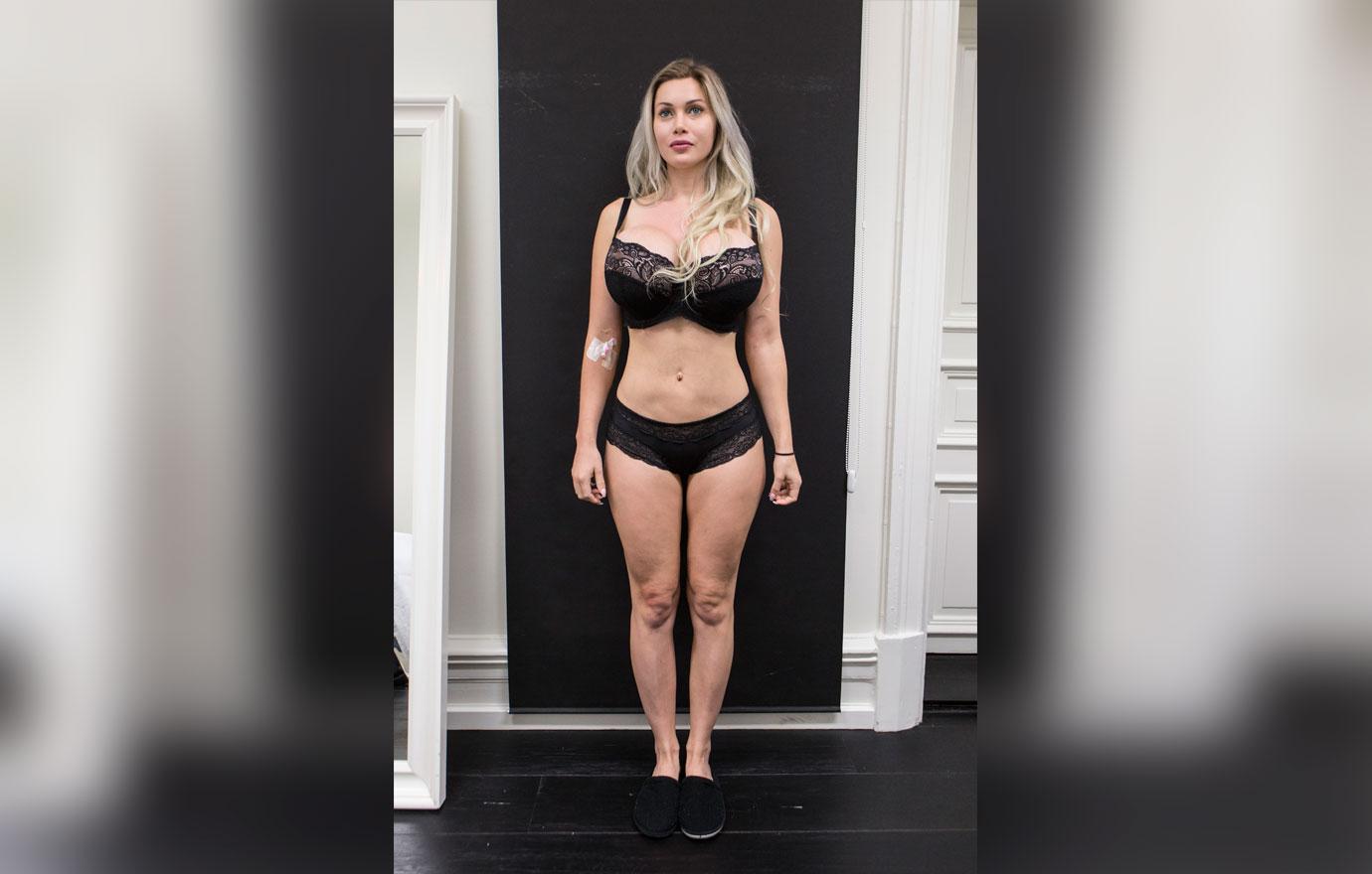 Pixee Fox Undergoes Plastic Surgery And Looks Like Jessica Rabbit
