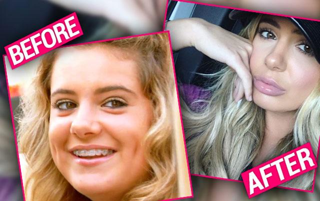 Reality Rhinoplasty Top Docs Say Brielle Biermann Got A Nose Job