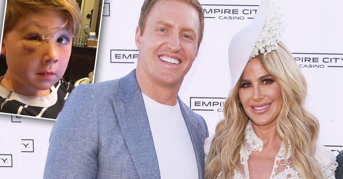 Kim Zolciak Son Kash Biermann’s Dog Bite Filmed For ‘Don’t Be Tardy’