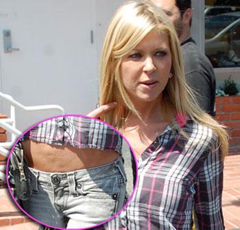 PHOTOS: Crop Top Catastrophe! Super Skinny Tara Reid Shows Off Botched ...