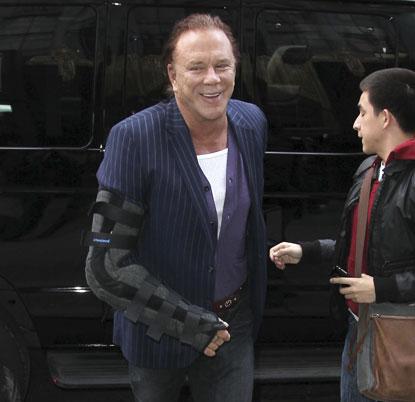 Mickey Rourke Has A Broken Arm