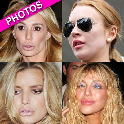 Plastic Surgery Disasters? 10 Celebs With Terrible Trout Pouts