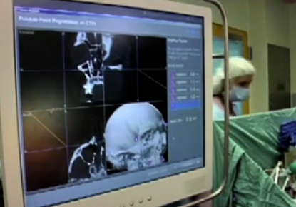 The Face Transplant Of Richard Lee Norris