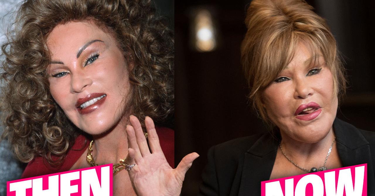 ‘Catwoman’ Jocelyn Wildenstein Says She’s Never Had Plastic Surgery