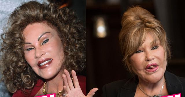 ‘Catwoman’ Jocelyn Wildenstein Says She’s Never Had Plastic Surgery