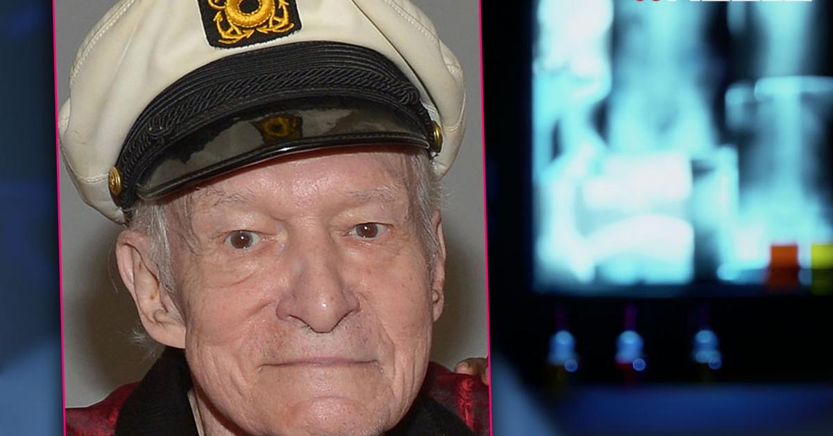 Hugh Hefner Had ‘Acute’ Back Pain In Finals Days Before Death