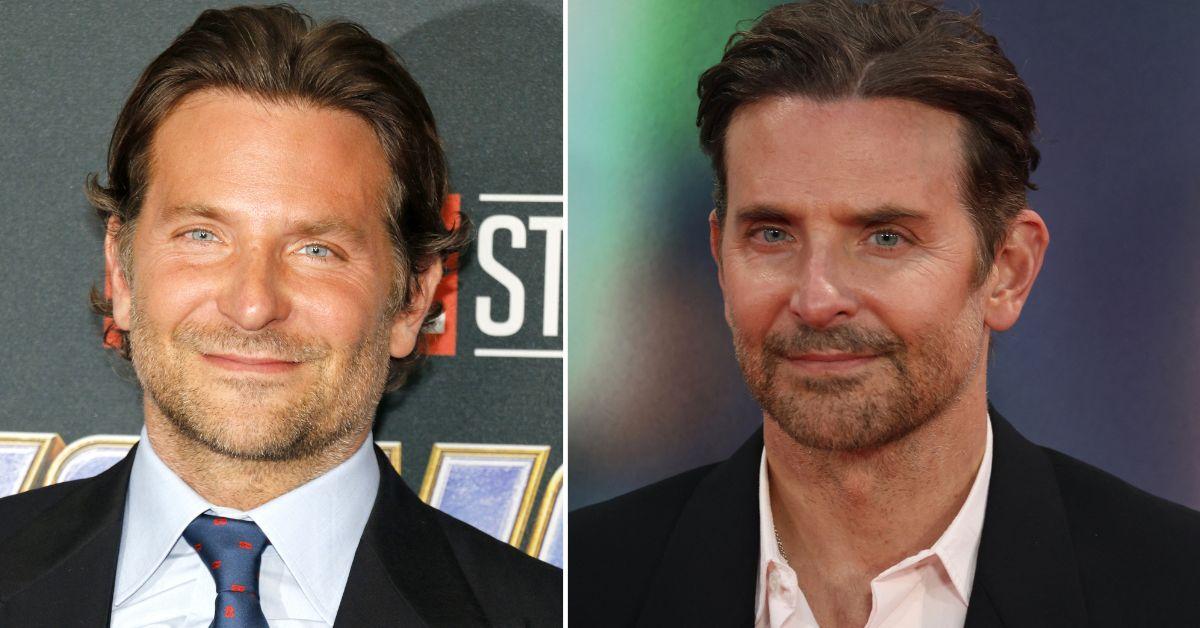 Bradley Cooper’s Plastic Surgery Disaster! Inside His Bizarre New Look