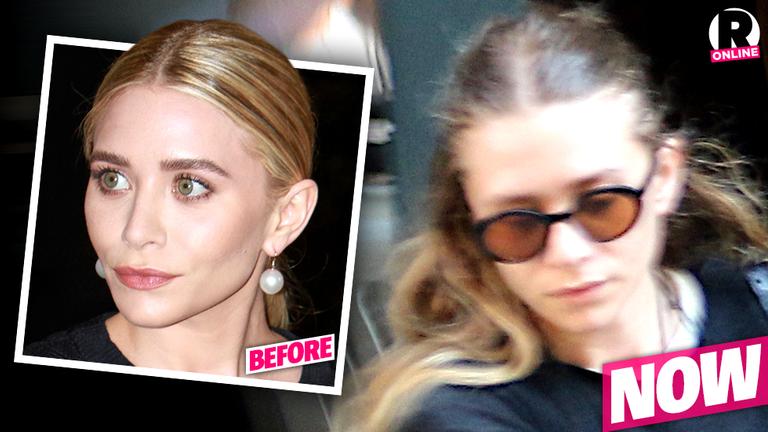 Tragic Turn: Ashley Olsen's Thinning Hair 'May Be Due To Lyme Disease ...