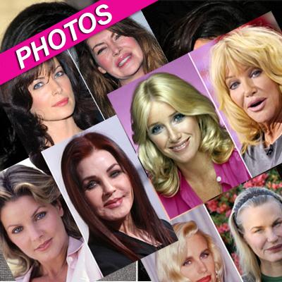 Plastic Surgery Disasters! 10 MORE Stars Who’ve Gone Too Far Under The ...