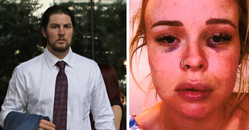 Dodgers Pitcher Trevor Bauer's Sexual Assault Accuser's Testimony ...