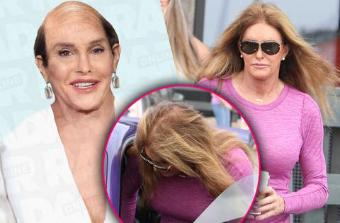 Caitlyn Jenner's Hair Loss EXPOSED—Transgender Star Going Bald!